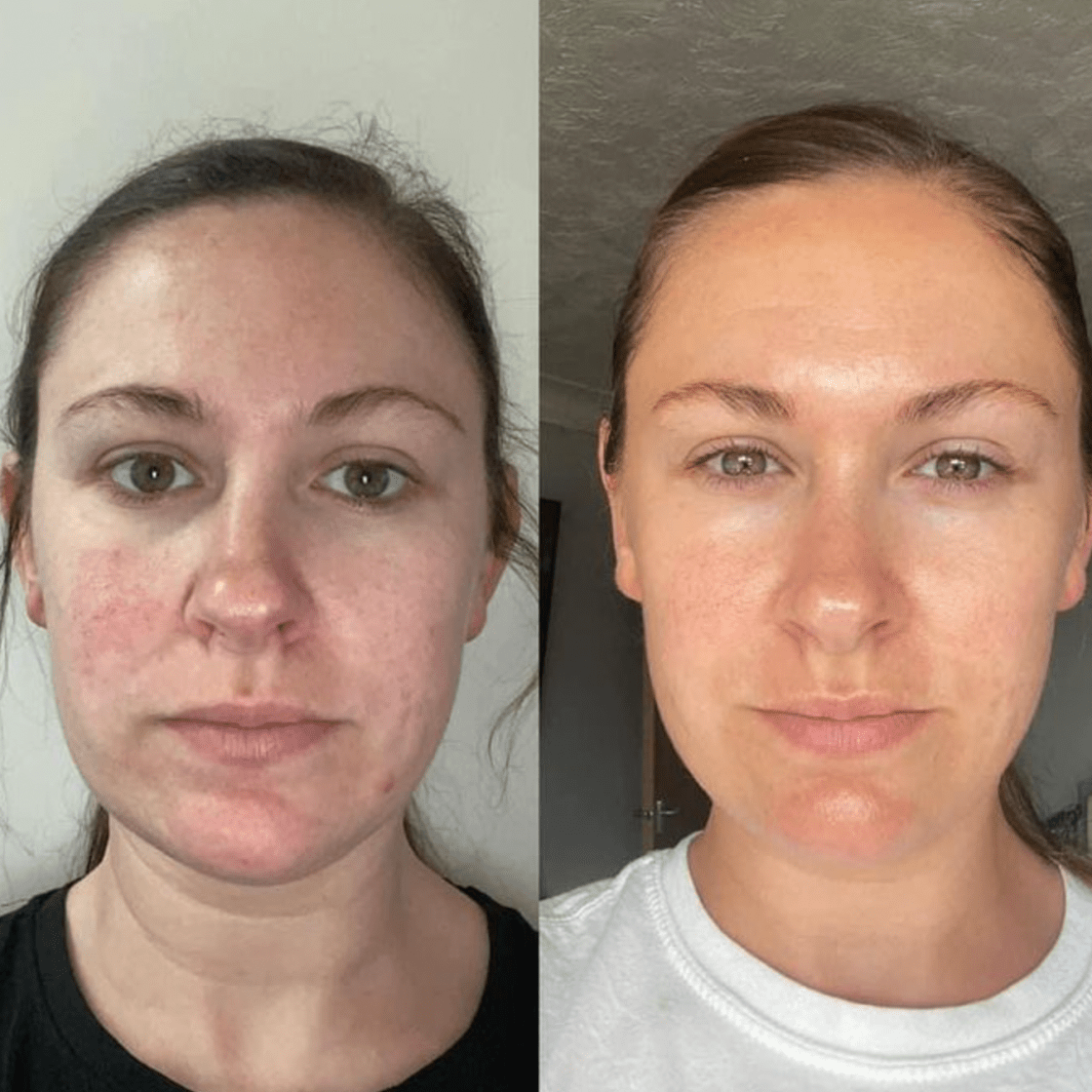 WellNature: Transform Your Skin with Our Overnight Collagen Face Mask